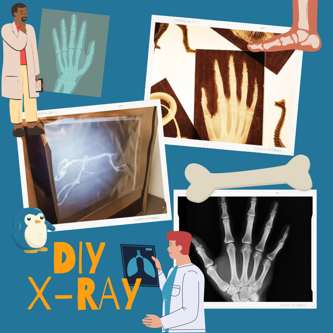 How are X-Ray images Shown? – Squizzel Box